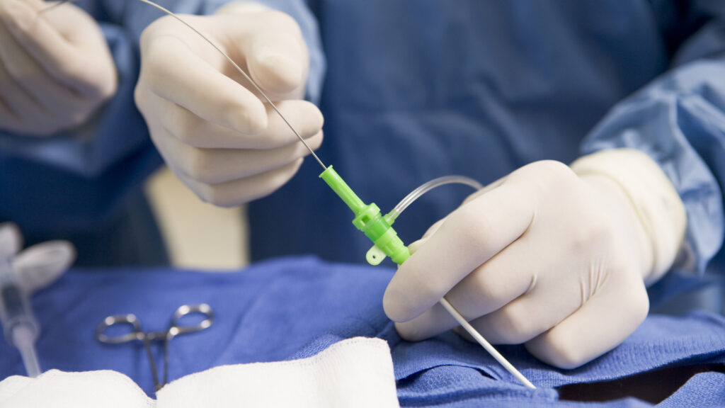 Watchman Implant Procedure | UAMS Health